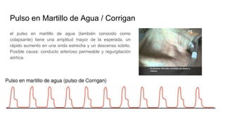 PULSOS SEMIOLOGIA.pptx