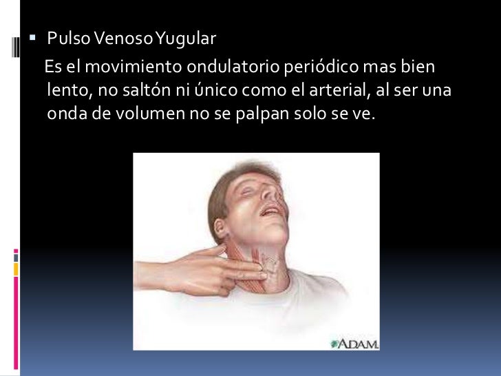 Pulso venoso yugular