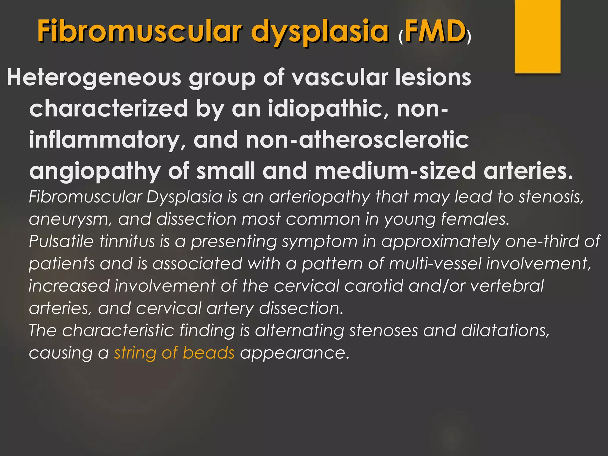 Pulstaile tinitus radiology | PPT