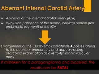 Pulstaile tinitus radiology | PPT