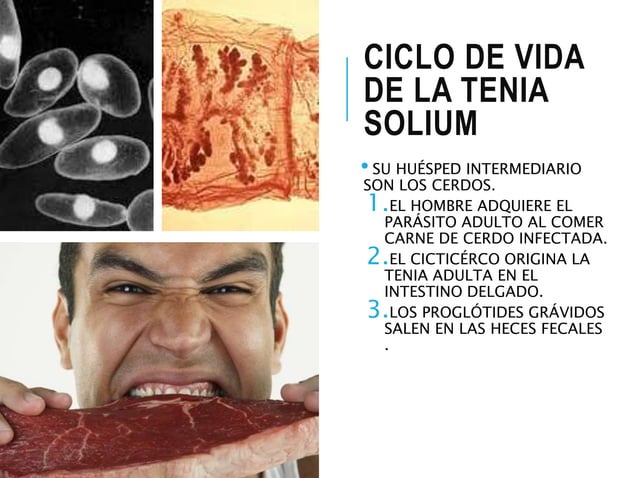 PULUPA TARIS KAREN BRIGETTE-CASO CLINICO-CISTICERCOSIS.pptx