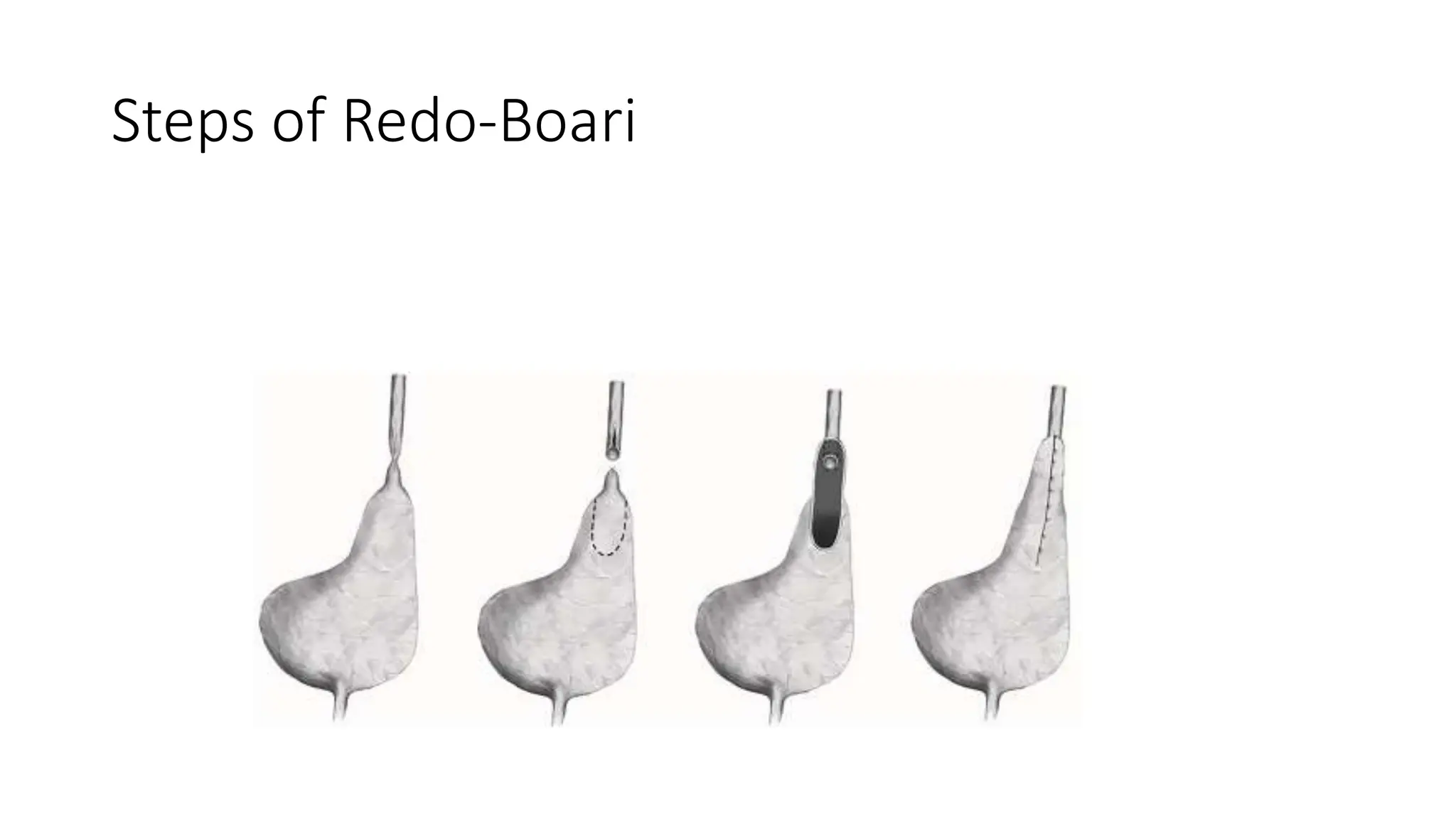 Pummi.pptx kjvuvuiuhhb vgviu vfdyi yu yyyyt | PPT