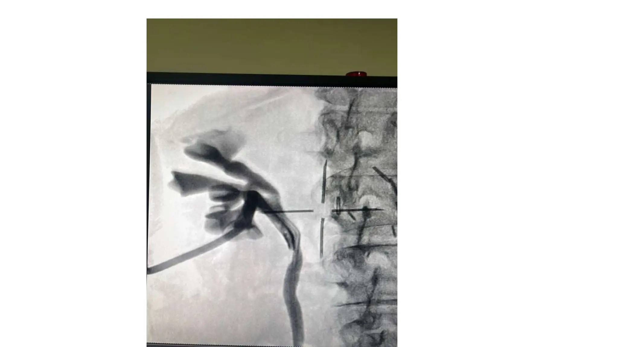 Pummi.pptx kjvuvuiuhhb vgviu vfdyi yu yyyyt | PPT