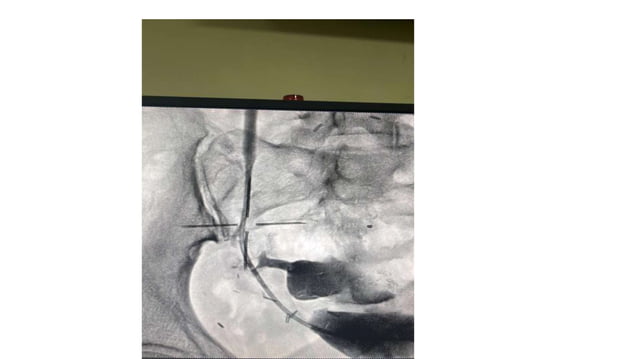 Pummi.pptx kjvuvuiuhhb vgviu vfdyi yu yyyyt | PPT | Free Download