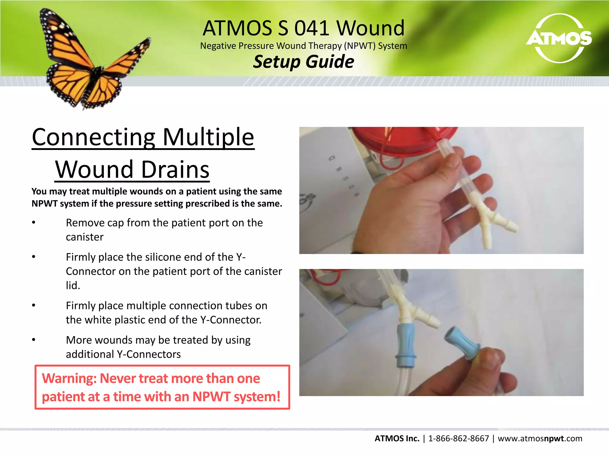 ATMOS NPWT System and Dressing Setup | PPTX
