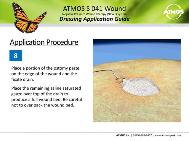 ATMOS NPWT System and Dressing Setup | PPTX