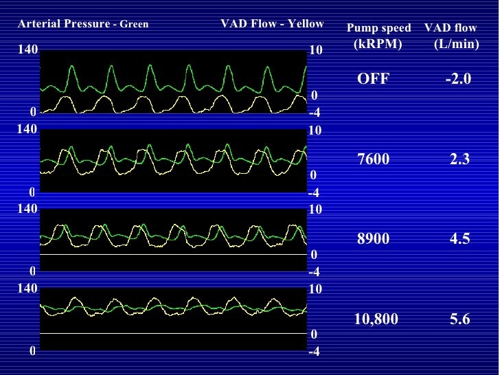 Development of an Axial Flow Left Ventricular Assist Device (LVAD) fr…