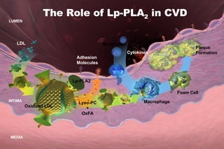 Atherosclerosis, pumpsandpipesmdhc | PPT