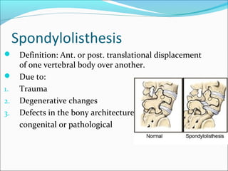 Traumatic Spondylolisthesis | PPT