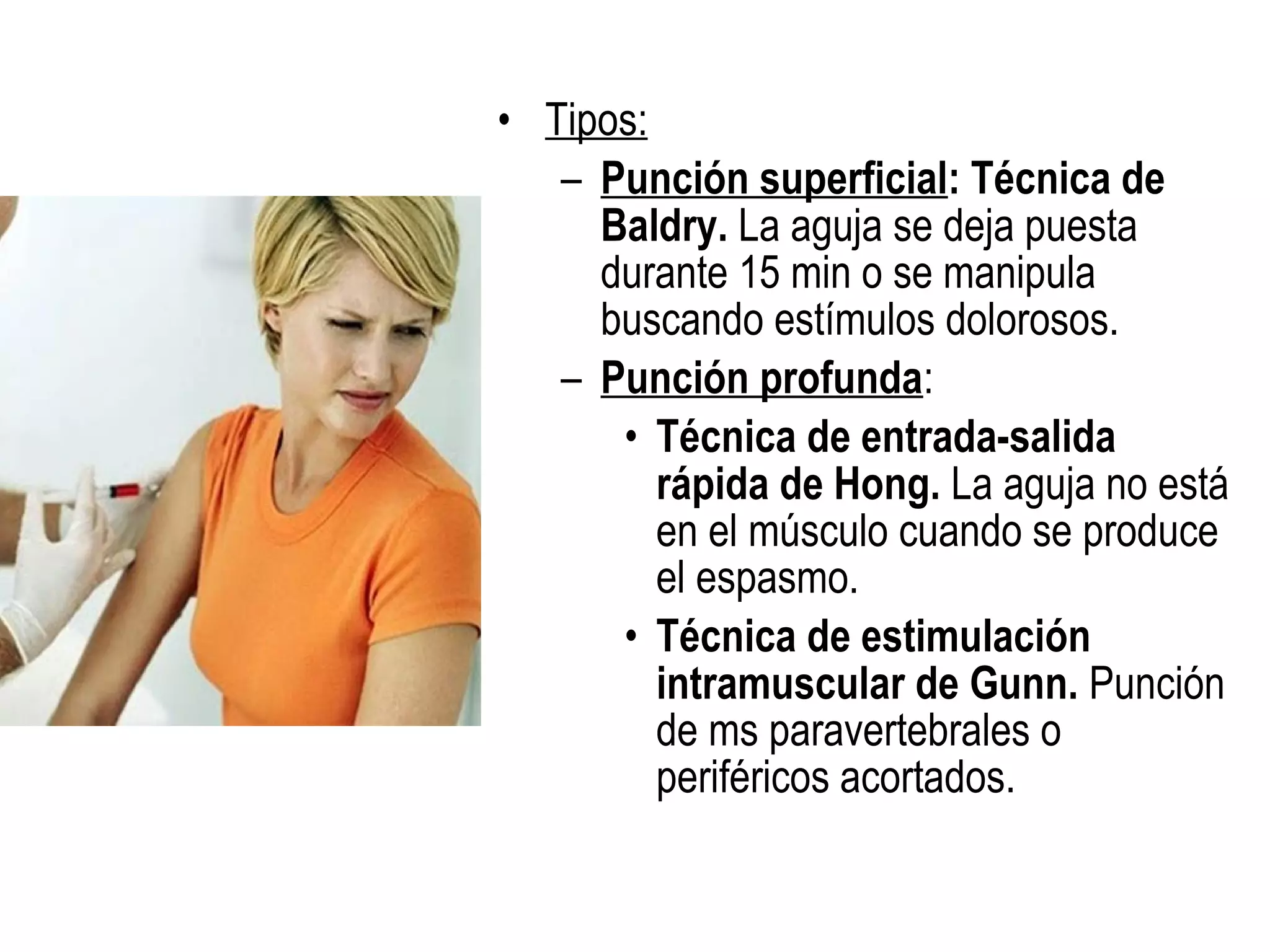 PUNCIÓN SECA EN EL TRATAMIENTO DE LOS PUNTOS GATILLO. Rehabilitación | PPT