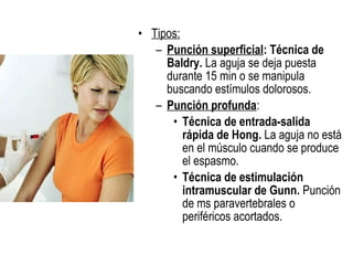 PUNCIÓN SECA EN EL TRATAMIENTO DE LOS PUNTOS GATILLO. Rehabilitación | PPT