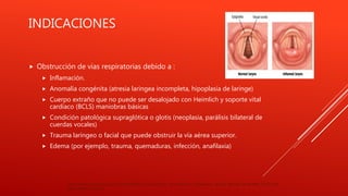 Punción Traqueal y Traqueostomía | PPTX