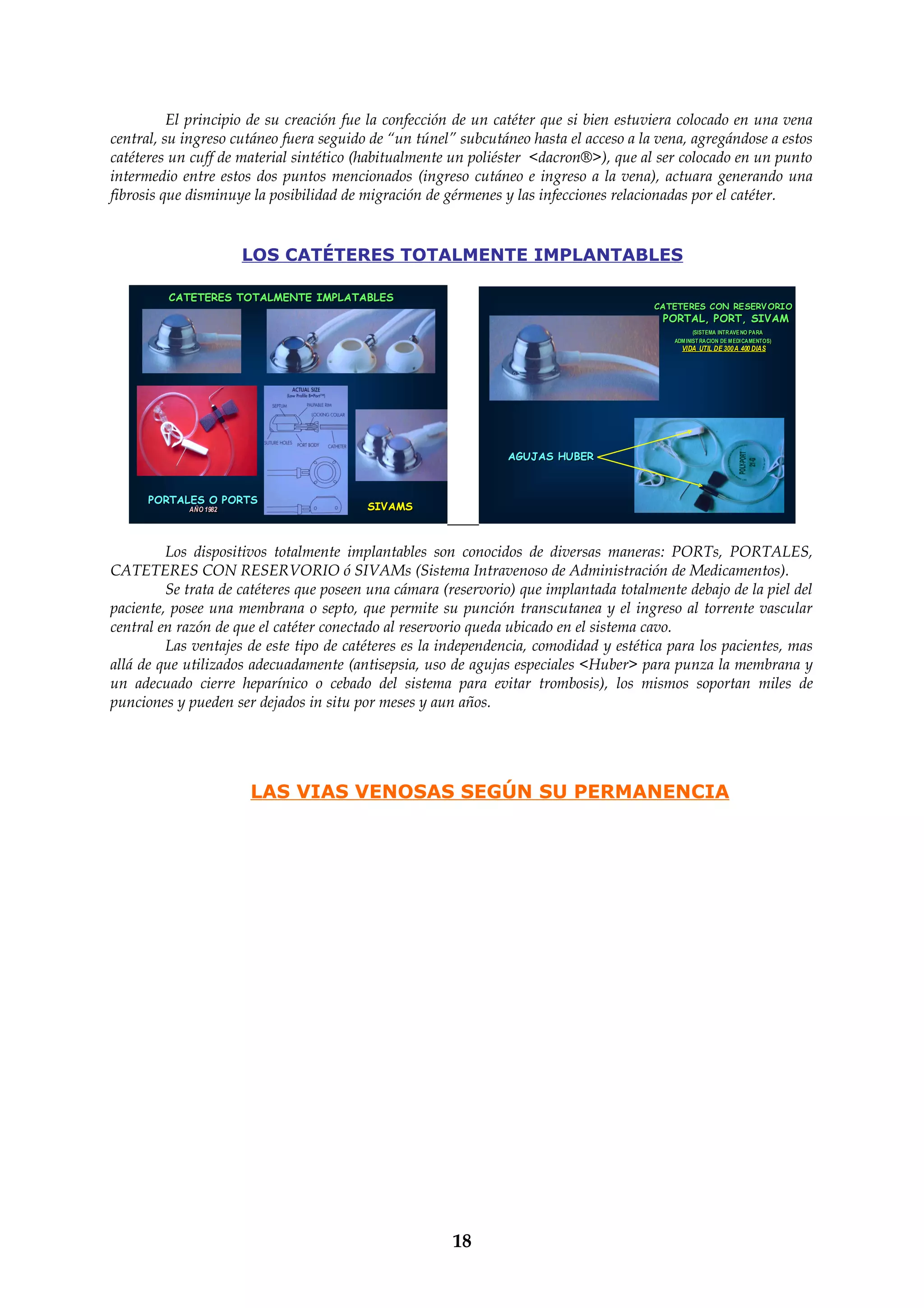 Punciones venosas centrales como lo hago | DOC