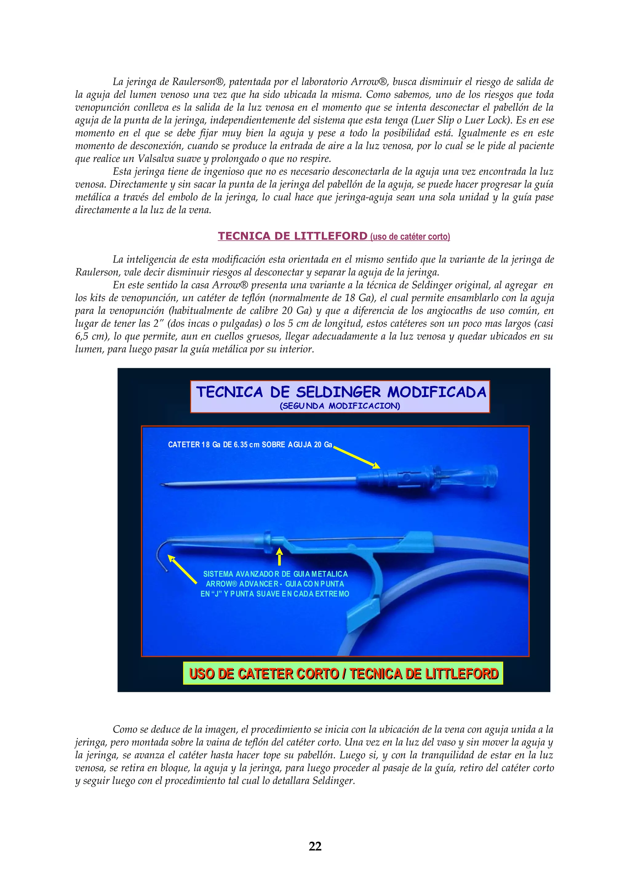 Punciones venosas centrales como lo hago | DOC