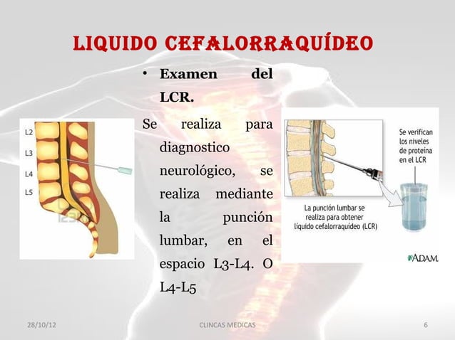 Puncion lumbar | PPT