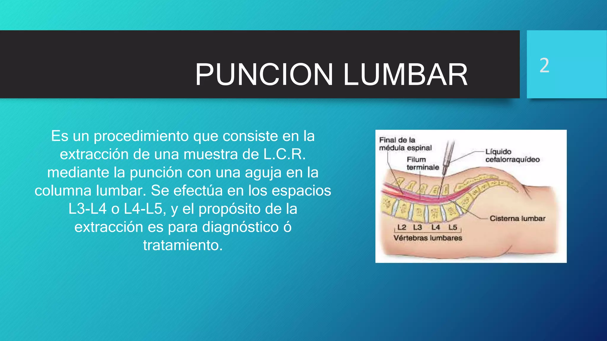 PUNCION LUMBAR.pptx
