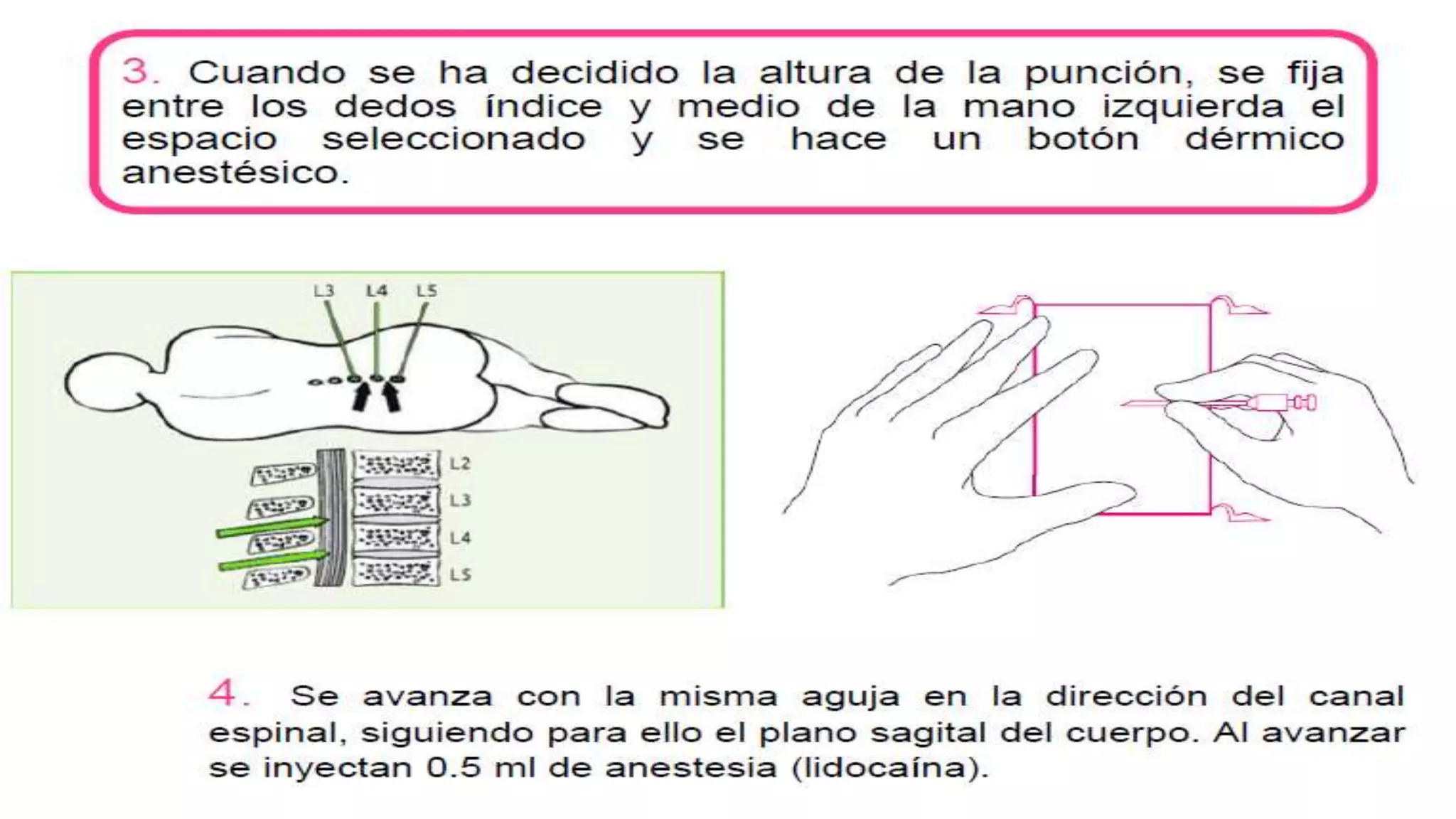 PUNCION LUMBAR CLASE LHyD.pptx
