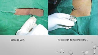 PUNCION LUMBAR CLASE LHyD.pptx