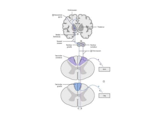 Punctate midline myelotomy | PPTX