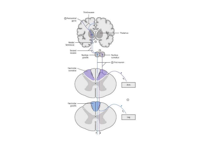 Punctate midline myelotomy | PPT