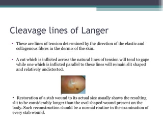 Punctured wounds | PPT