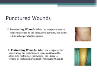 Perforating Wound