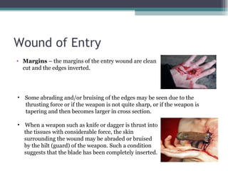 Punctured wounds | PPT