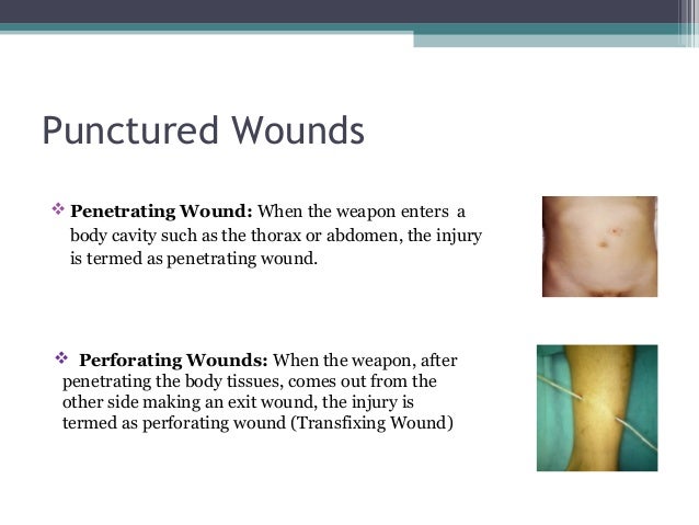 Punctured wounds