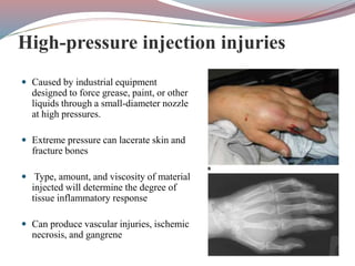 Puncture wounds and bites | PPTX