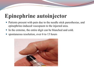 Puncture wounds and bites | PPTX