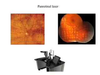 diabetes treatment | PPT