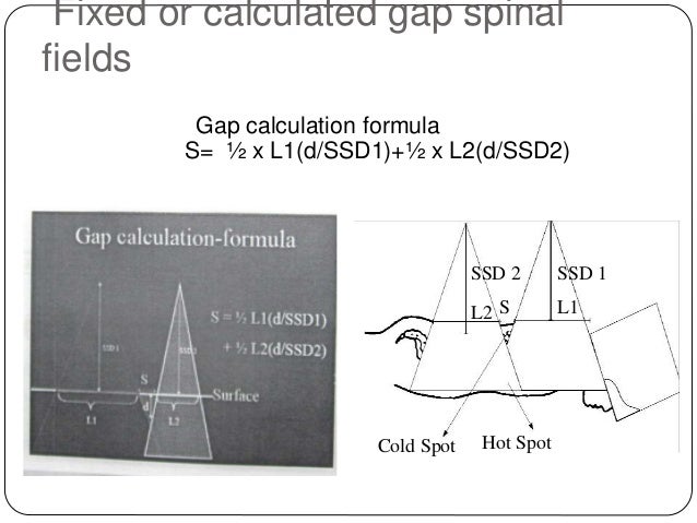 Puneet medulloblastoma ppt