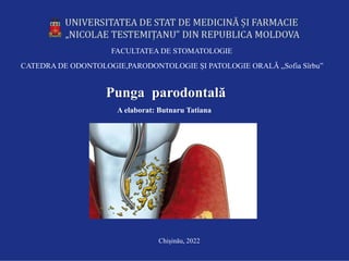 Punga parodontală.pptx