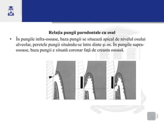 Punga parodontală.pptx