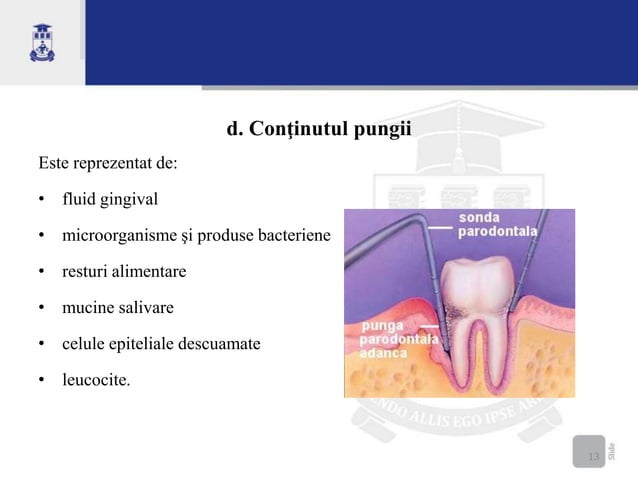 Punga parodontală.pptx