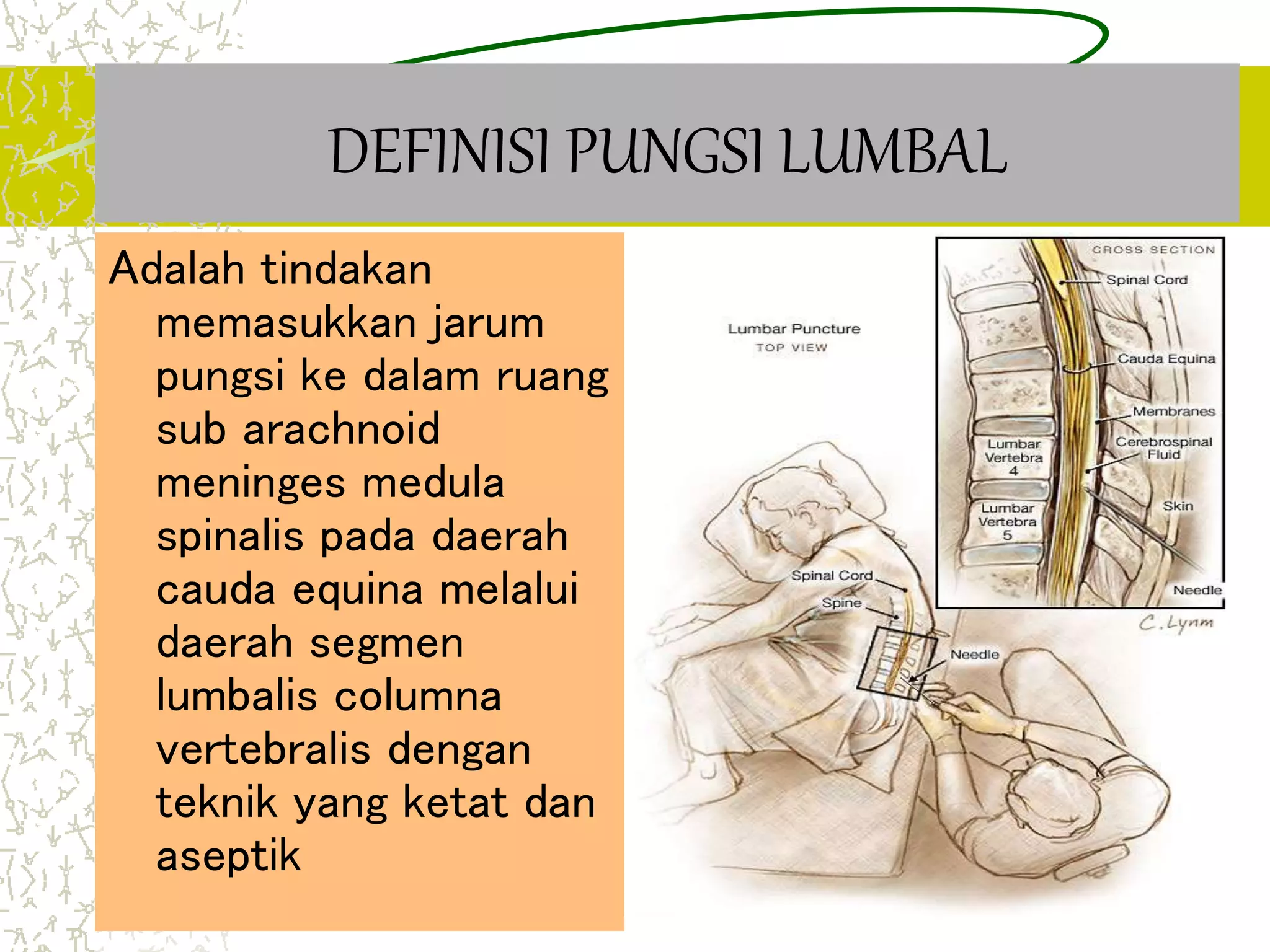 PUNGSI_LUMBAL.ppt