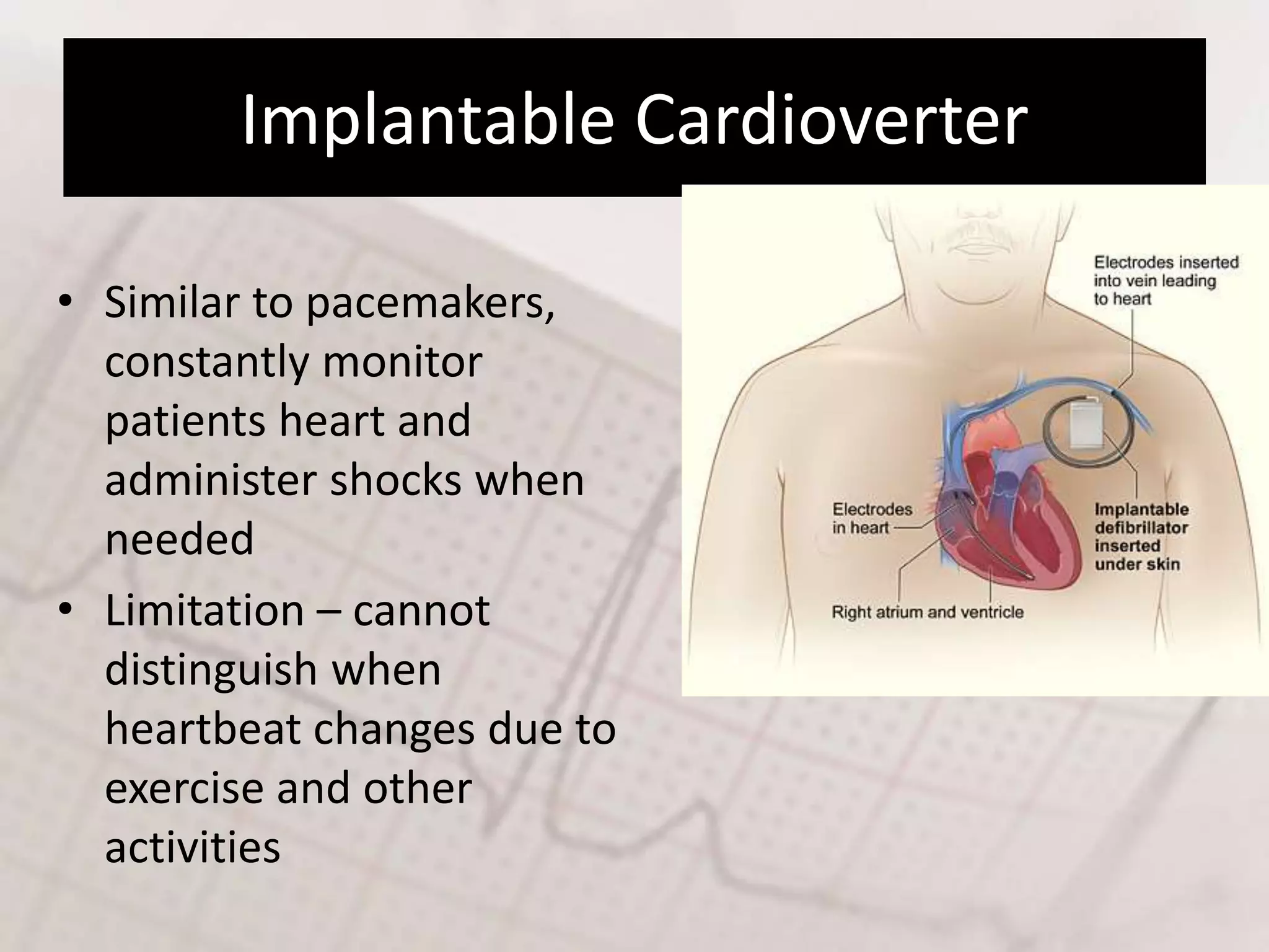 Defibrillation & Cardioversion | PPTX