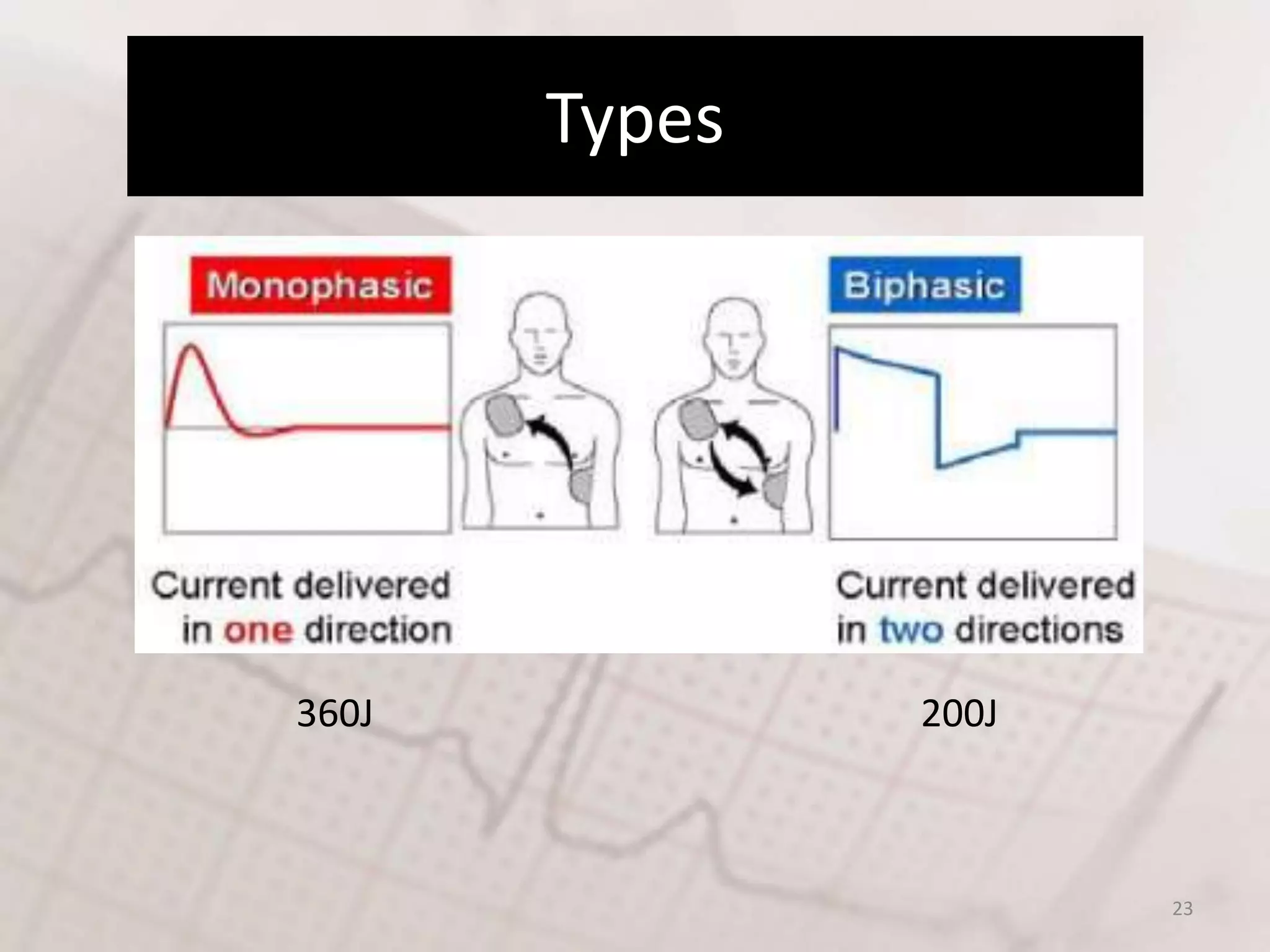 Defibrillation & Cardioversion | PPTX
