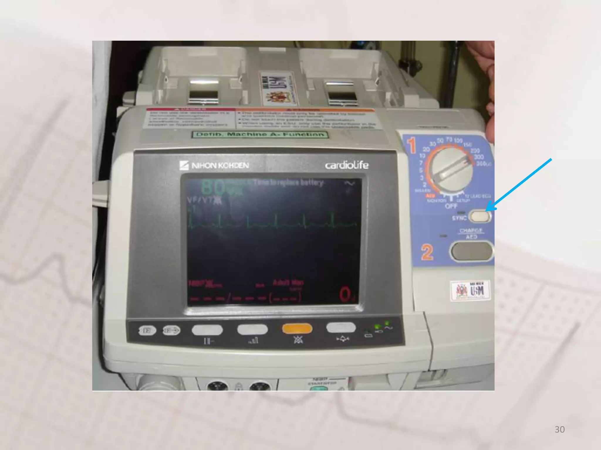 Defibrillation & Cardioversion | PPTX
