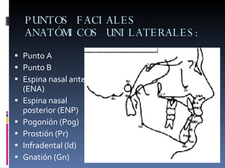 Puntos Cefalometricos | PPT
