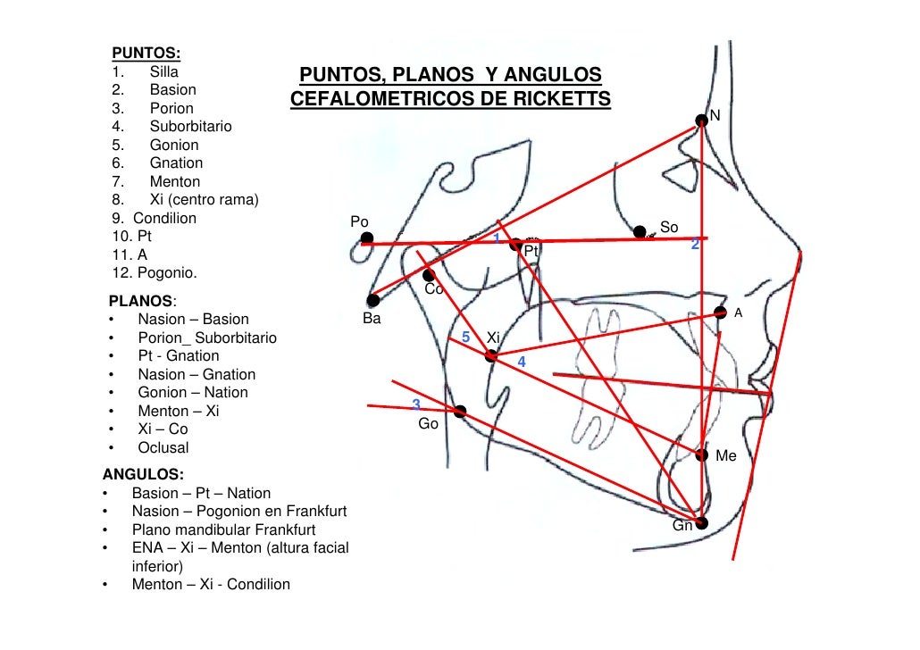 Puntos cefalometricos