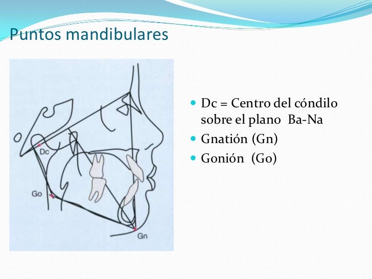 Puntos Cefalomëtricos