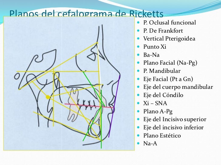 Puntos cefalomëtricos