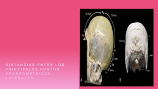 puntos craneometricos | PPTX