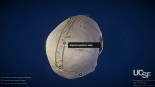 puntos craneometricos | PPTX