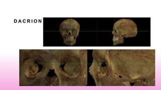 puntos craneometricos | PPTX