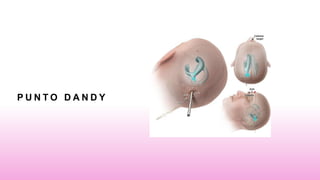 puntos craneometricos | PPTX