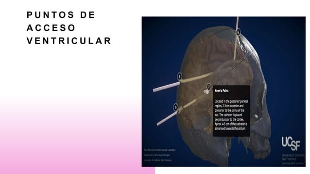 puntos craneometricos | PPTX | Brain and Nervous System Disorders ...