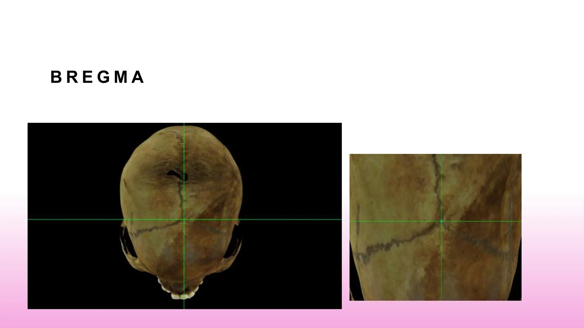 puntos craneometricos milagros.pptx de importancia | PPT