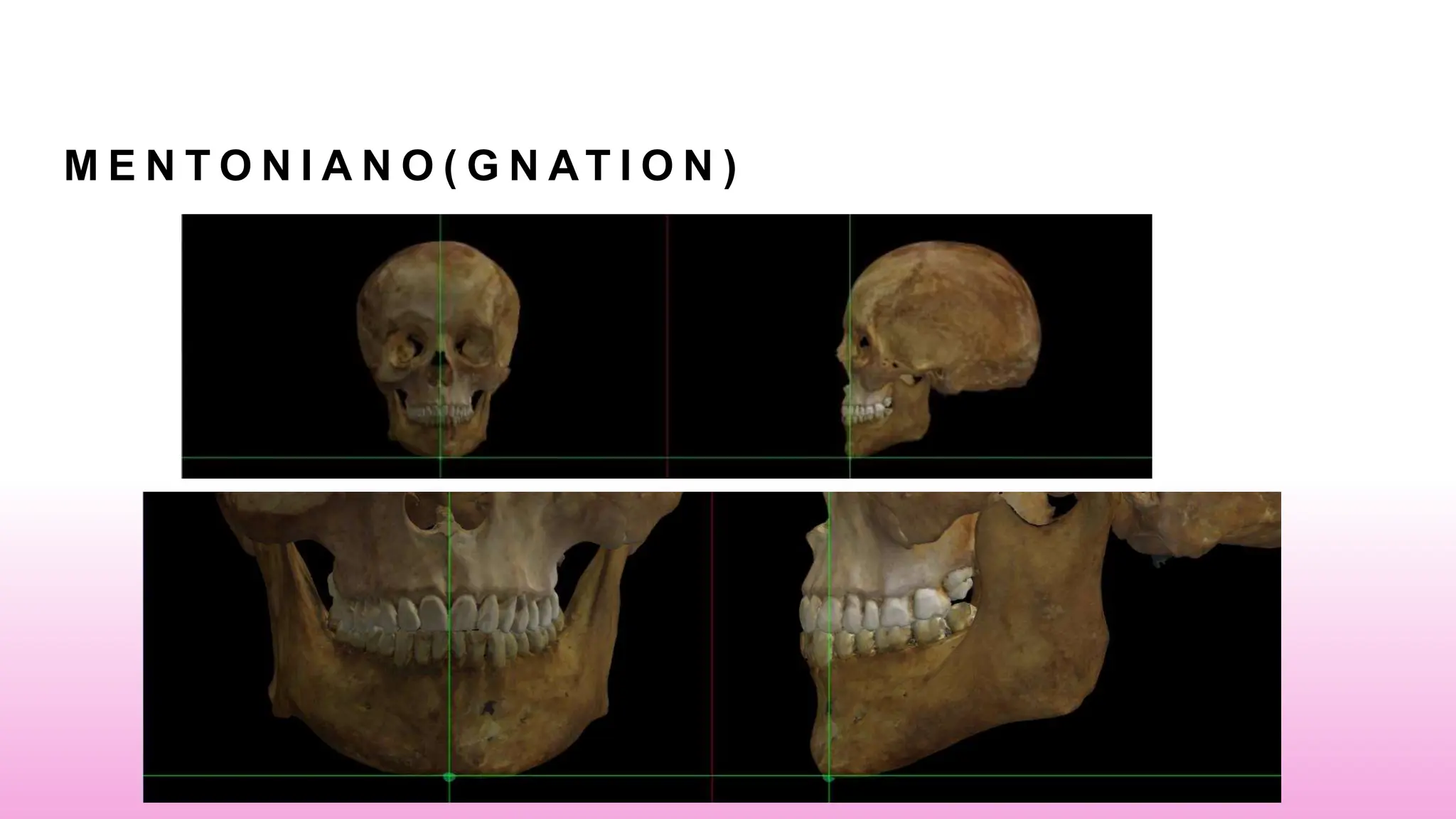 puntos craneometricos milagros.pptx de importancia | PPT